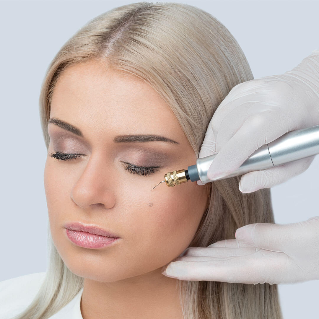 What is a Plasma Pen? | Dog News Articles